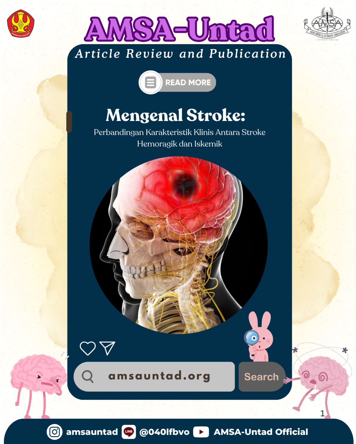 Mengenal Stroke: Perbandingan Karakteristik Klinis Antara Stroke ...